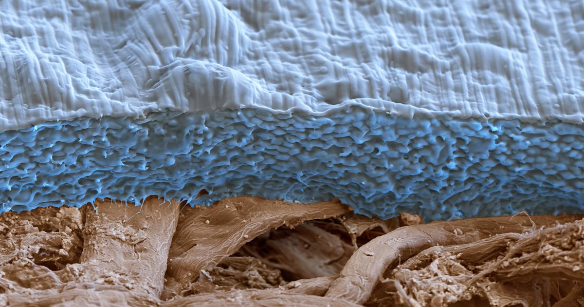 The future of plastics
